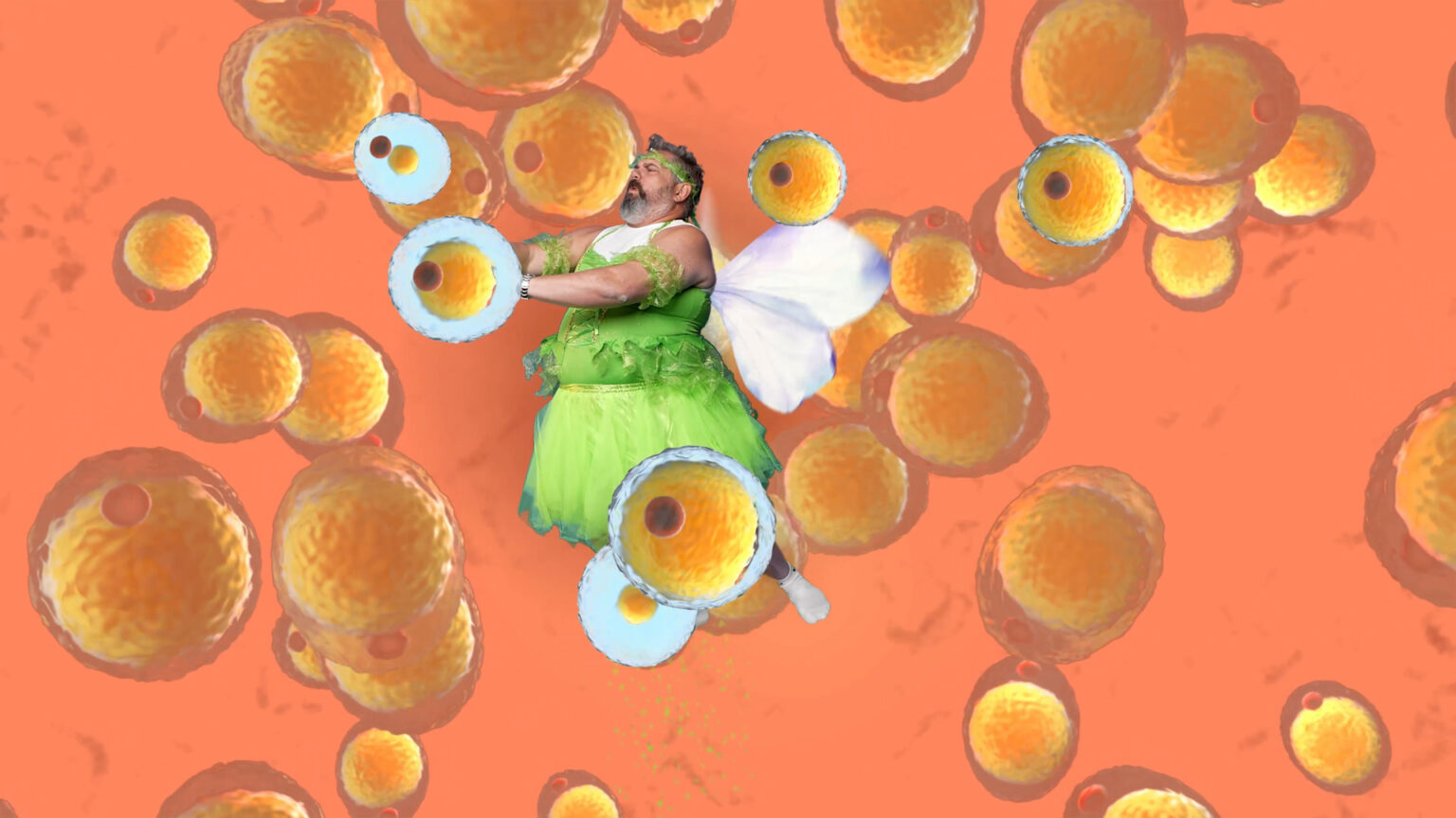 Gluteal Softening | Fluff Fairy | Dr. William Miami | BBL | Florida